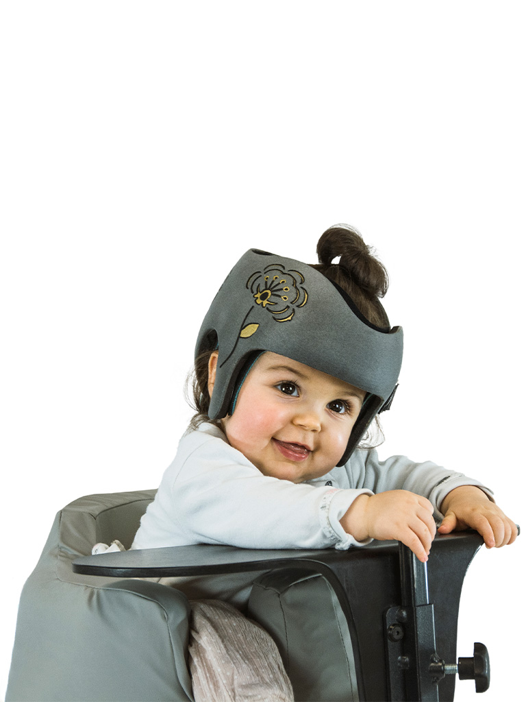 3D Printed Cranial Remolding Orthosis: Manufacturing Guide | Sculpteo