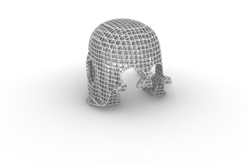 3D Printed Cranial Remolding Orthosis: Manufacturing Guide | Sculpteo