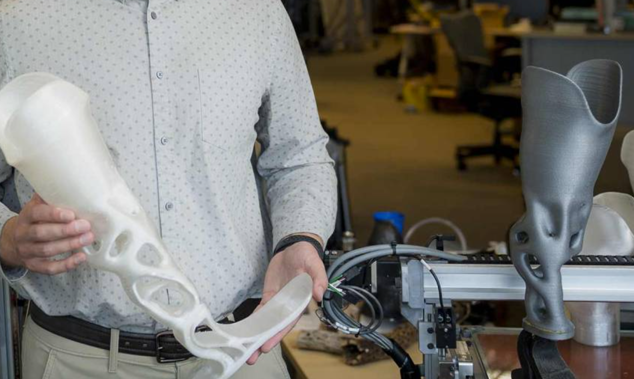 3D Printed prosthetic leg & lower limb components