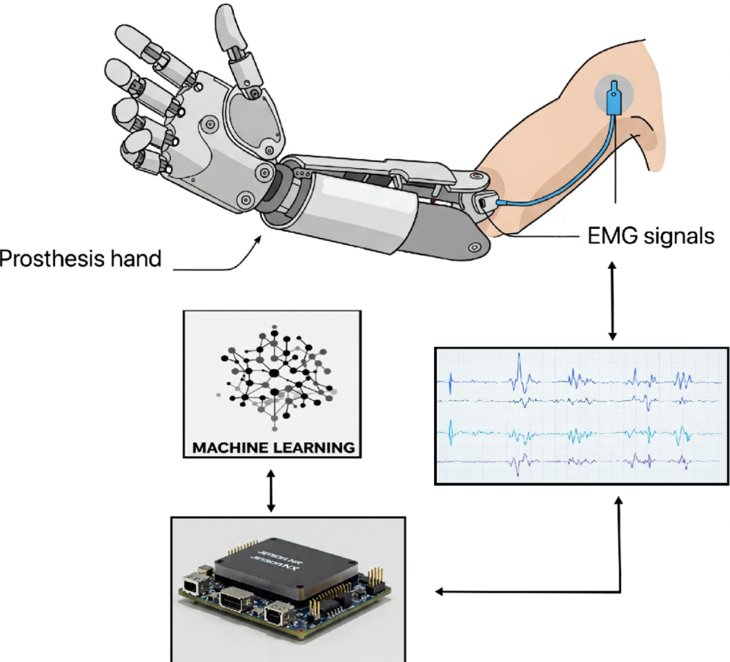 3D Printed Arm Prosthetic: Advanced Bionic Limbs